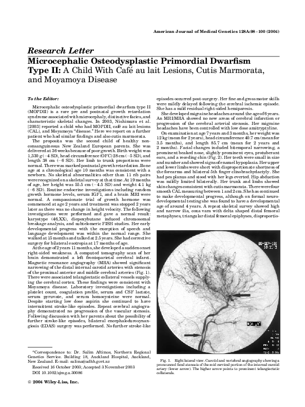 (PDF) Microcephalic osteodysplastic primordial dwarfism type II: A ...