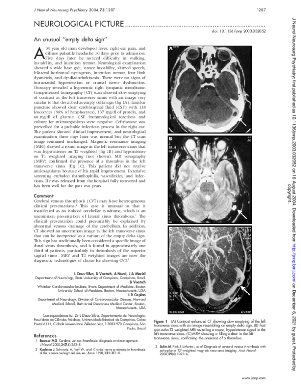 (PDF) An unusual "empty delta sign | Barbara Voetsch - Academia.edu