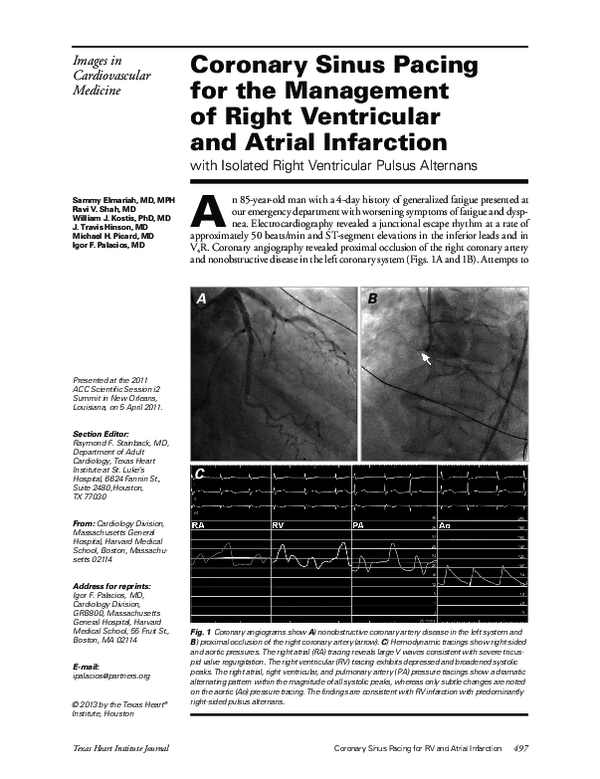 (PDF) Coronary sinus pacing for the management of right ventricular and ...