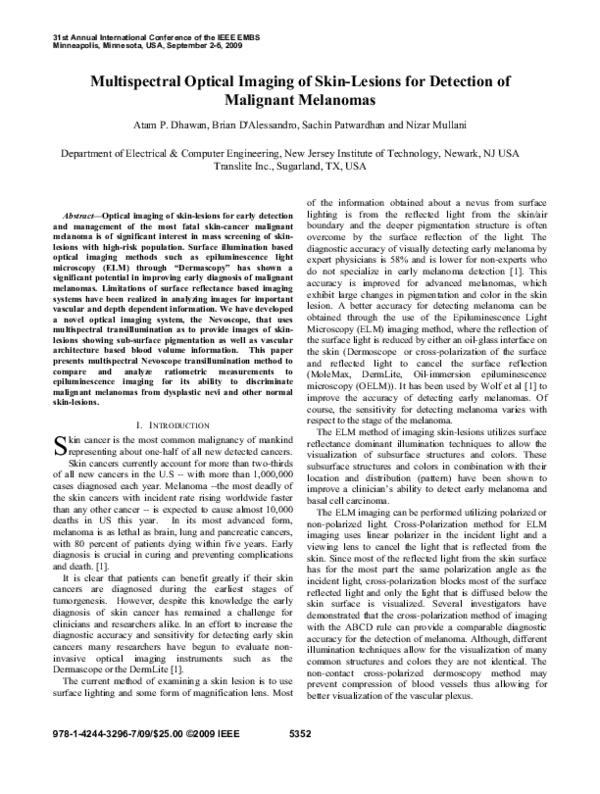 (PDF) Multispectral optical imaging of skin-lesions for detection of ...