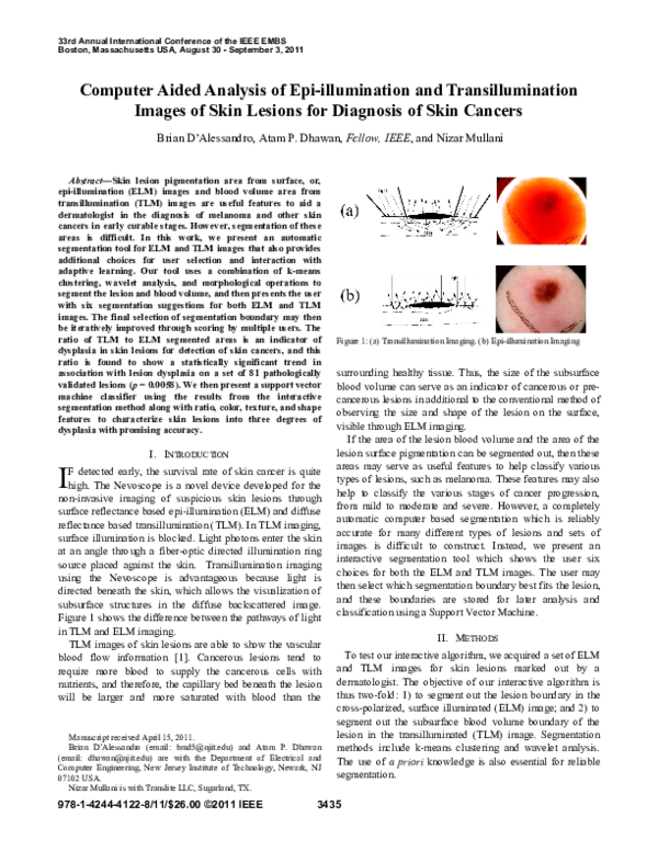 (PDF) Computer aided analysis of epi-illumination and transillumination ...