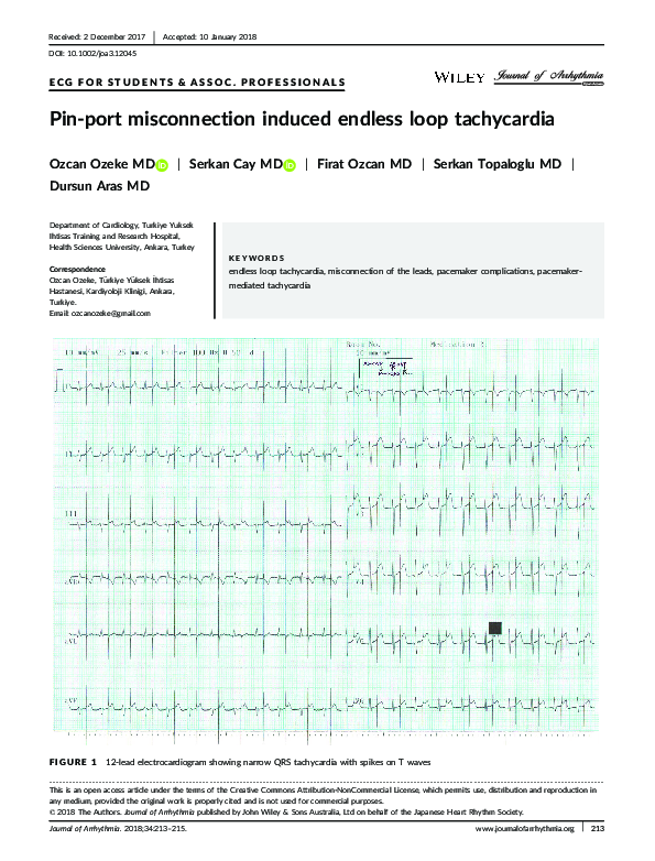 (PDF) Pin-port misconnection induced endless loop tachycardia | Özcan ...