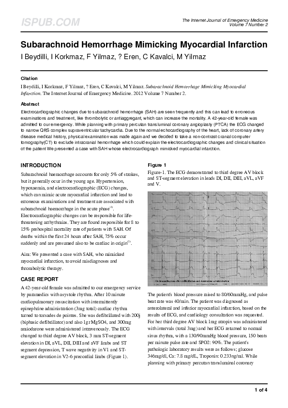 (PDF) Subarachnoid Hemorrhage Mimicking Myocardial Infarction