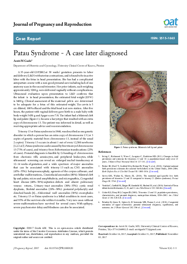 (PDF) Patau Syndrome - A case later diagnosed