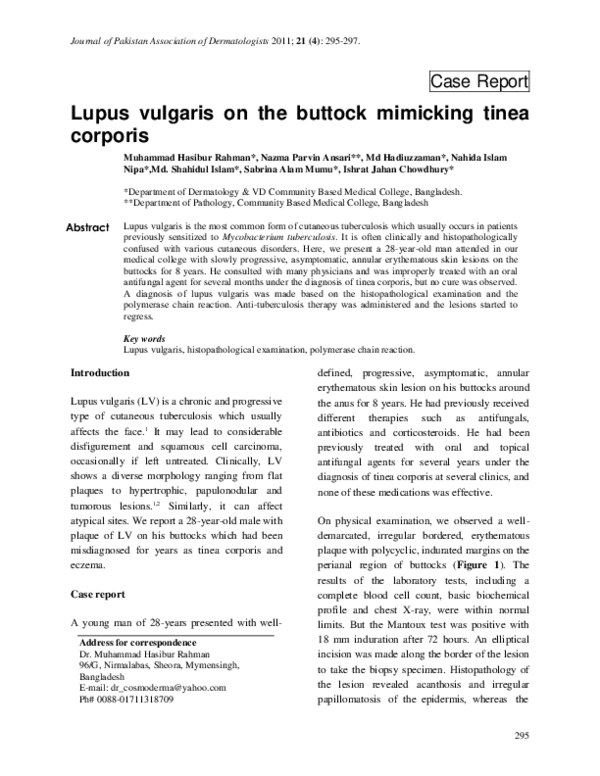 (PDF) A case report | Suvendu Behera - Academia.edu