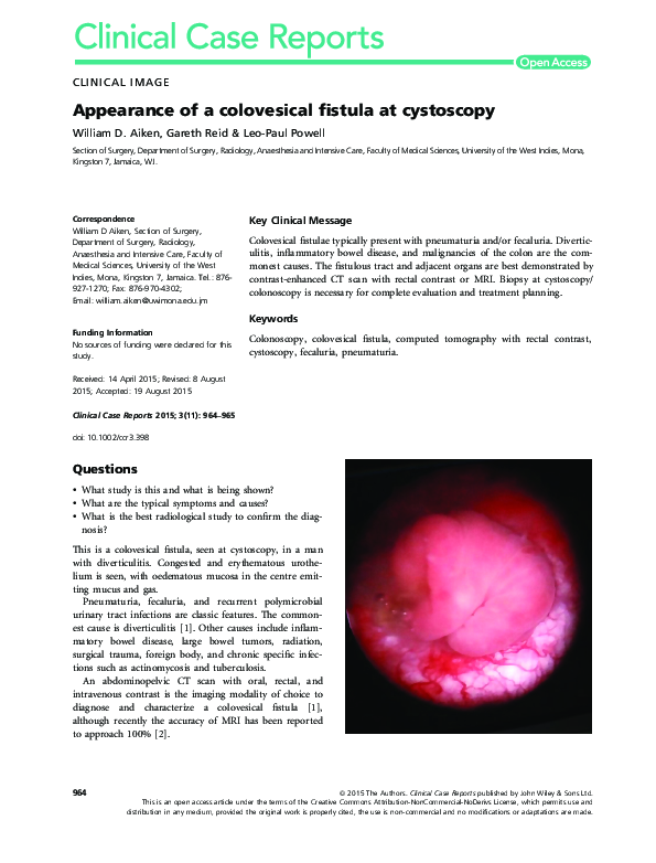 (PDF) Appearance of a colovesical fistula at cystoscopy