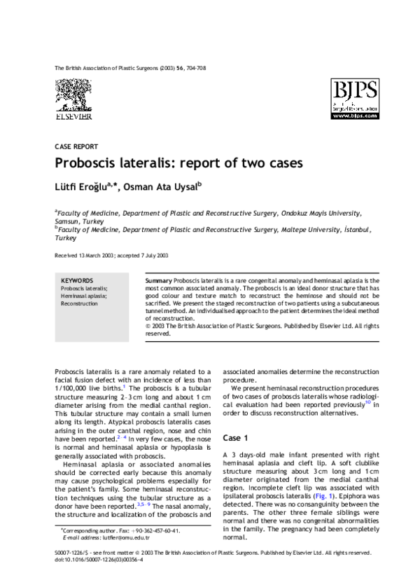 (PDF) Proboscis lateralis: report of two cases