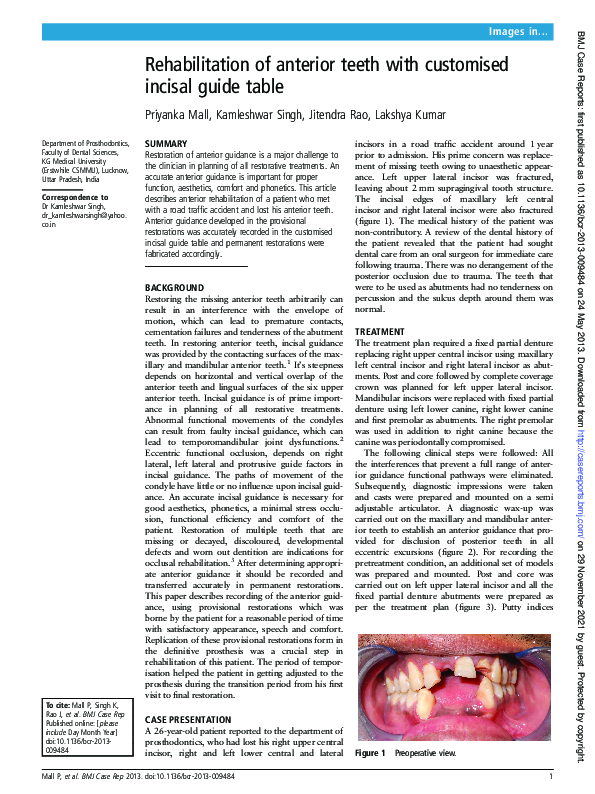 (PDF) Rehabilitation of anterior teeth with customised incisal guide table