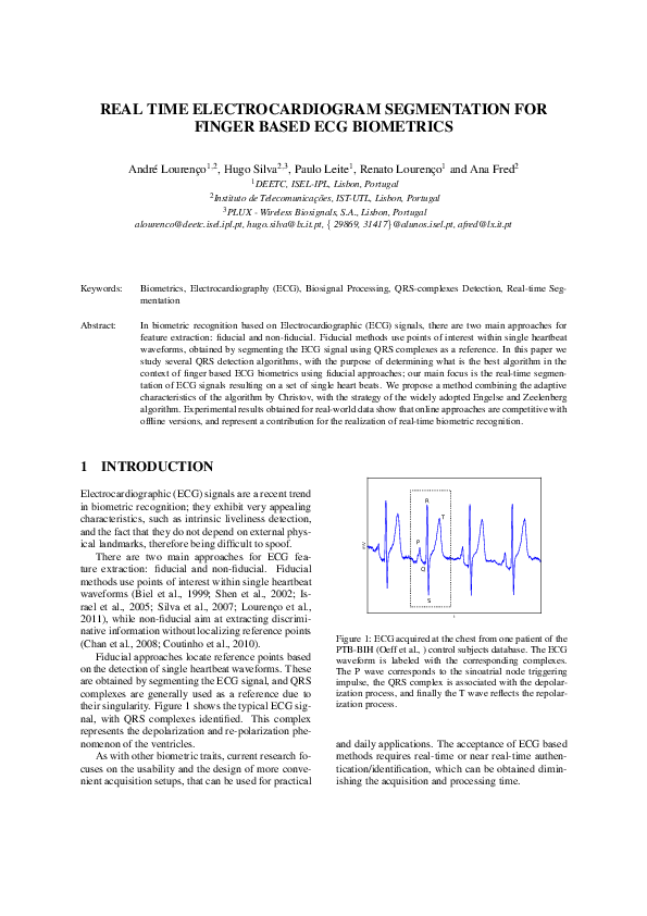 (PDF) Real Time Electrocardiogram Segmentation for Finger based ECG ...