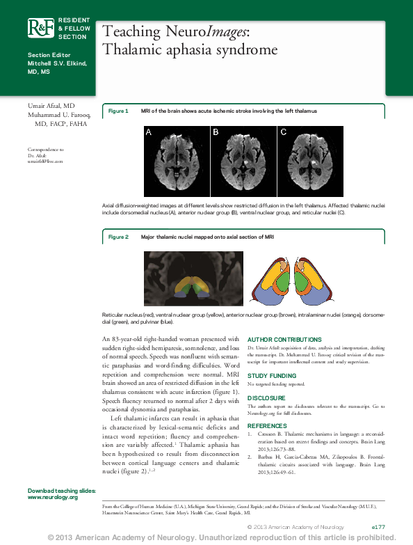 (PDF) Teaching NeuroImages: Thalamic aphasia syndrome