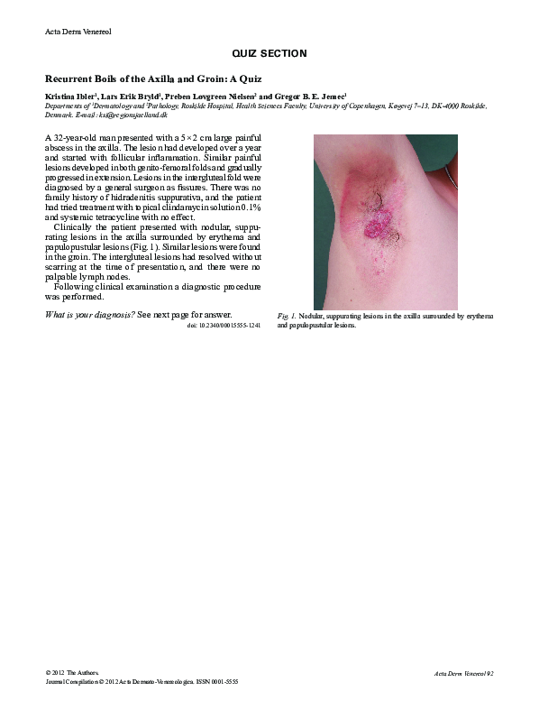 (PDF) Recurrent Boils of the Axilla and Groin: A Quiz