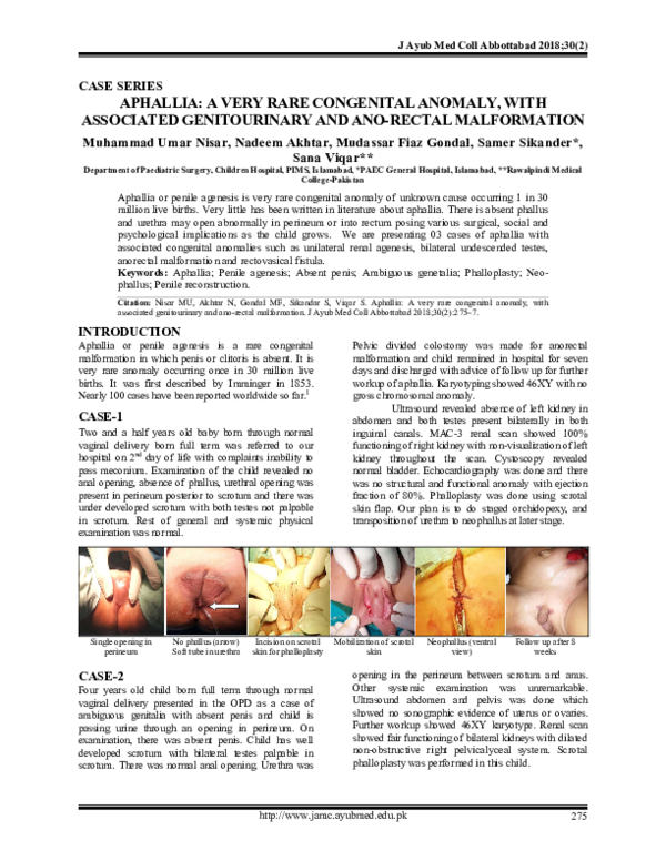 (PDF) Aphallia: A Very Rare Congenital Anomaly, With Associated ...