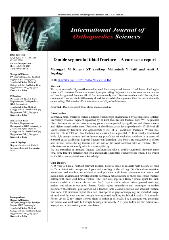 Pdf Double Segmental Tibial Fracture A Rare Case Report