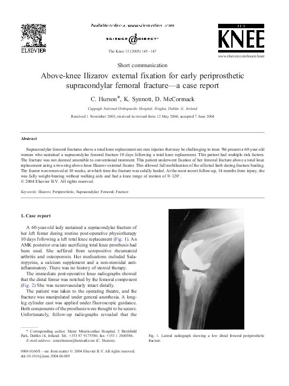 (PDF) Above-knee Ilizarov external fixation for early periprosthetic ...