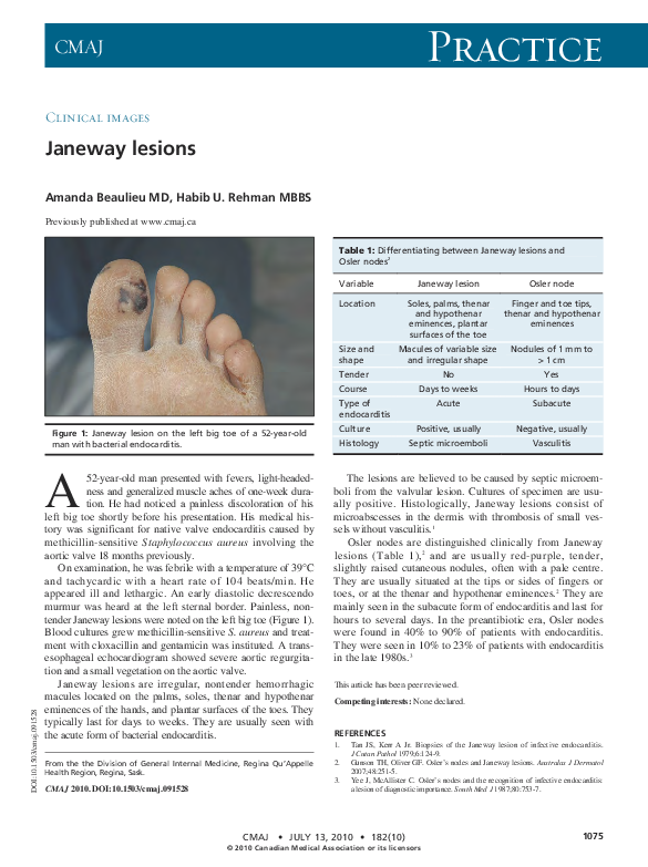 (PDF) Janeway lesions
