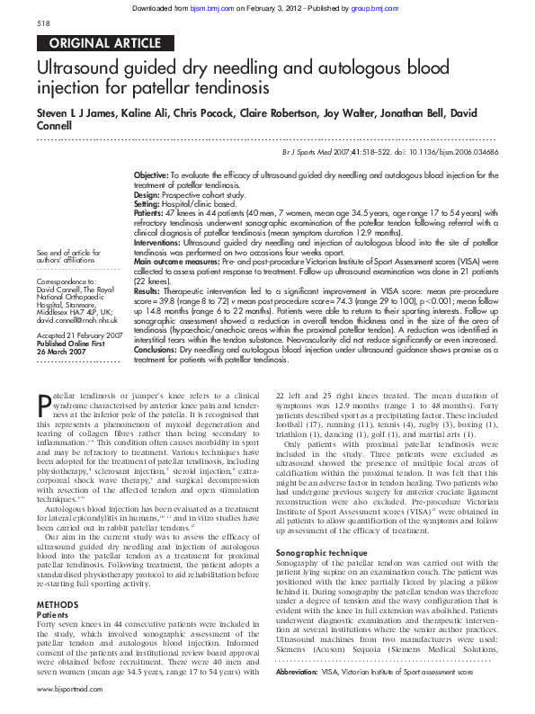 (PDF) Ultrasound guided dry needling and autologous blood injection for ...