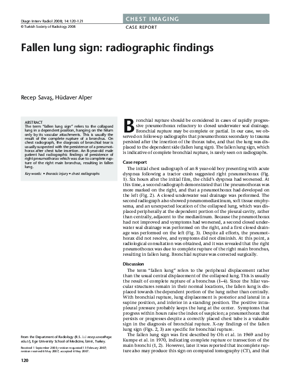 (PDF) Fallen lung sign: radiographic findings