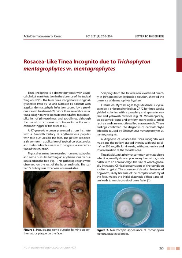 (PDF) Rosacea-like tinea incognito due to Trichophyton mentagrophytes ...