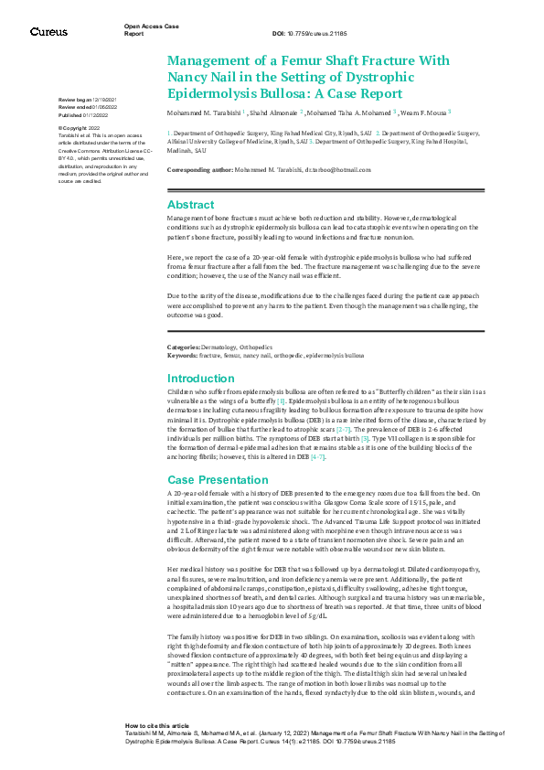 (PDF) Management of a Femur Shaft Fracture With Nancy Nail in the ...