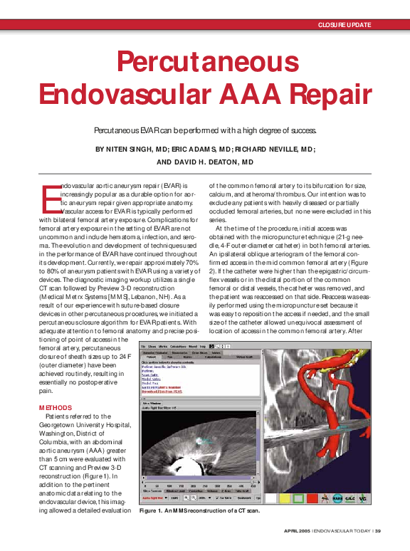 (PDF) Percutaneous Endovascular AAA Repair