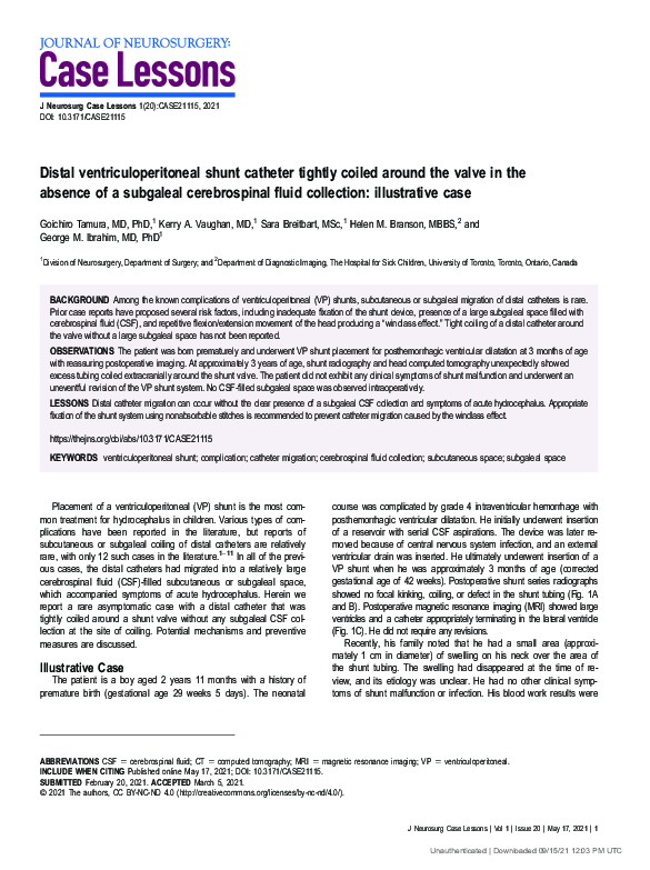 (PDF) Distal ventriculoperitoneal shunt catheter tightly coiled around ...