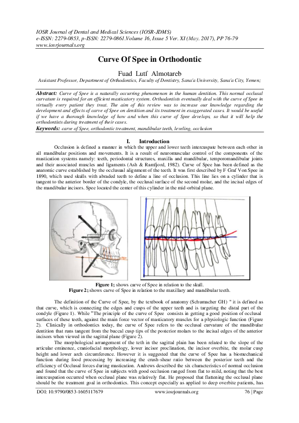 (PDF) Curve Of Spee in Orthodontic