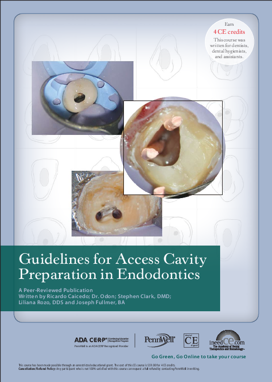 (PDF) Guidelines for Access Cavity Preparation in Endodontics