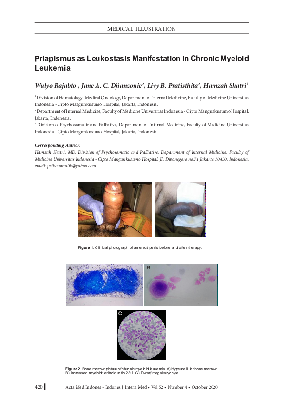 (PDF) Priapismus as Leukostasis Manifestation in Chronic Myeloid Leukemia