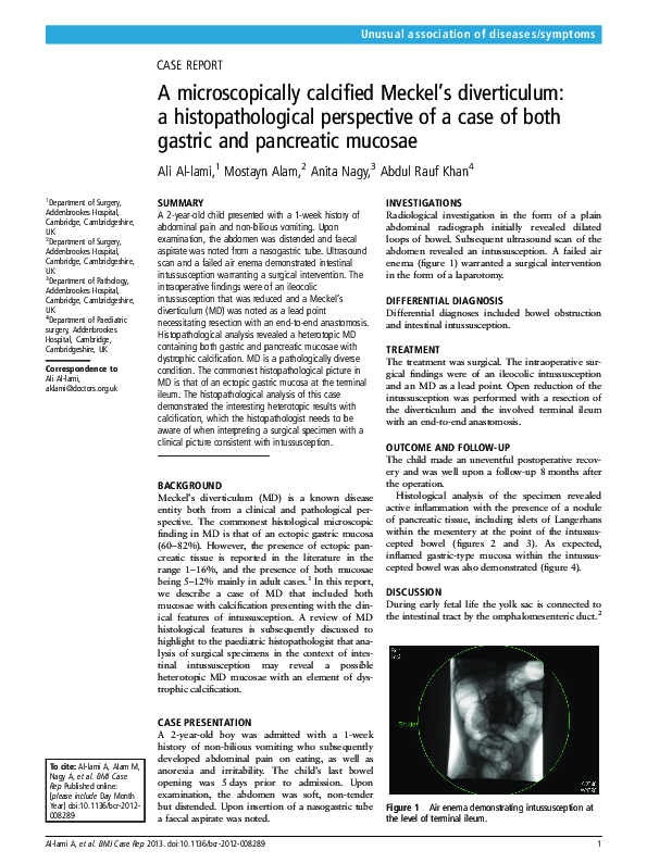 (PDF) A microscopically calcified Meckel's diverticulum: a ...