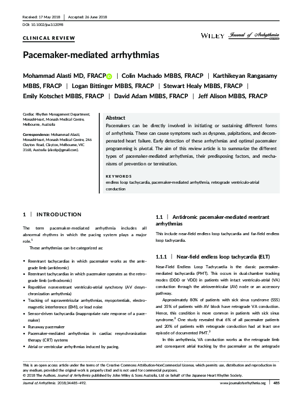 (PDF) Pacemaker‐mediated arrhythmias
