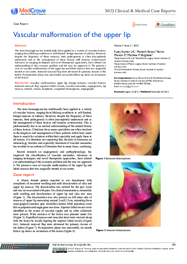 (PDF) Vascular Malformation of the Upper Lip