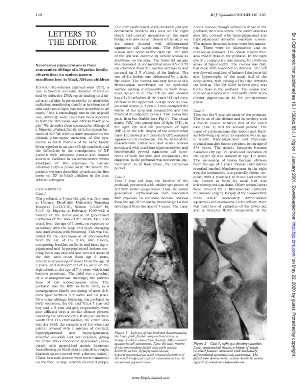 (PDF) Spontaneous extrusion of subconjunctival cysticercous cyst: a ...