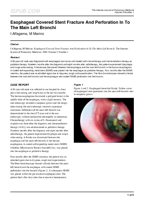 (PDF) Esophageal Covered Stent Fracture And Perforation In To The Main ...