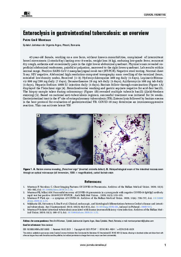 (PDF) Enteroclysis in gastrointestinal tuberculosis: an overview