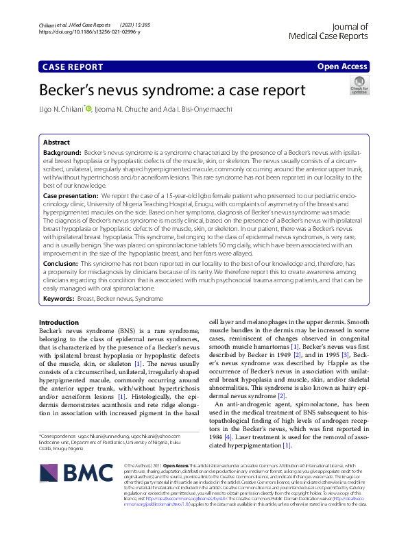 Pdf Beckers Nevus Syndrome A Case Report Dalia Hossam