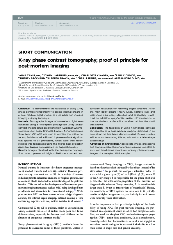 (PDF) X-ray Phase Contrast Tomography; Proof of principle for post ...