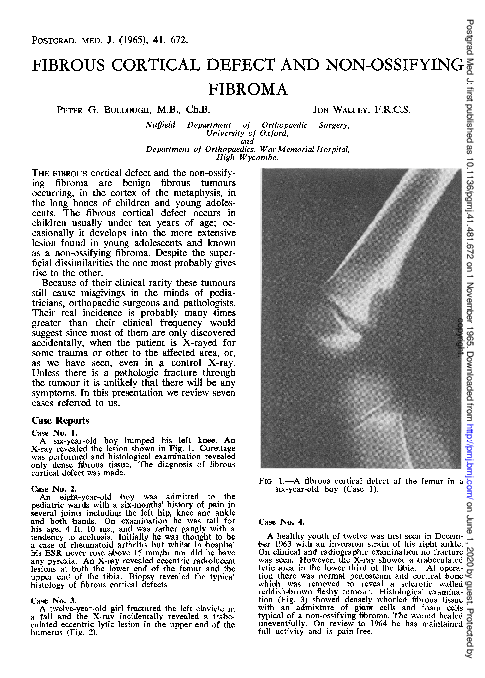 (PDF) Fibrous Cortical Defect in Children