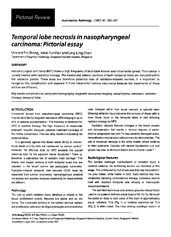 (PDF) Temporal lobe necrosis in nasopharyngeal carcinoma: Pictorial essay