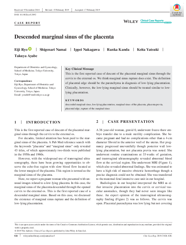 (PDF) Descended marginal sinus of the placenta