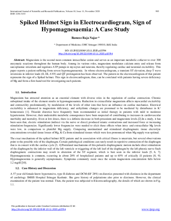 (PDF) Spiked Helmet Sign in Electrocardiogram, Sign of Hypomagnesaemia ...