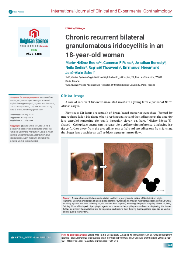 (PDF) Chronic recurrent bilateral granulomatous iridocyclitis in an 18 ...