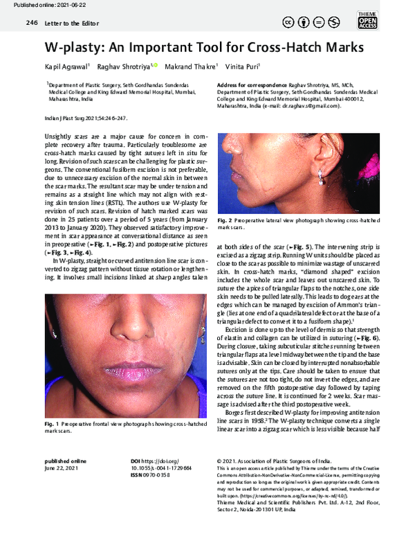 (PDF) W-plasty: An Important Tool for Cross-Hatch Marks
