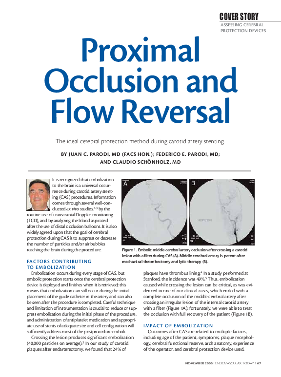 (PDF) Proximal Occlusion and Flow Reversal The ideal cerebral ...