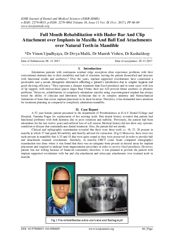 (PDF) Mouth Rehabilitation with Hader Bar And Clip Attachment over ...