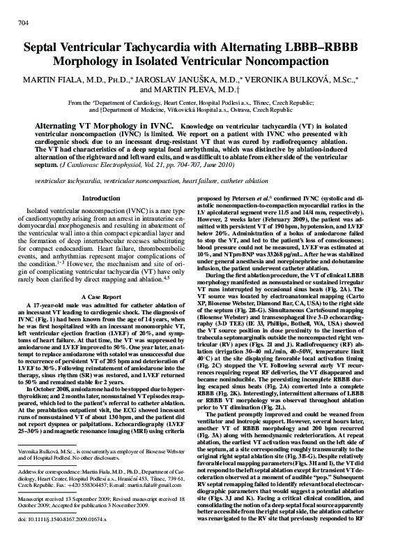 (PDF) Septal Ventricular Tachycardia with Alternating LBBB-RBBB ...