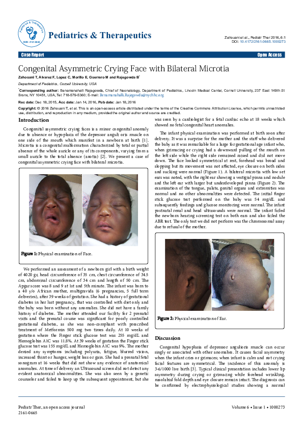 (PDF) Congenital Asymmetric Crying Face with Bilateral Microtia ...