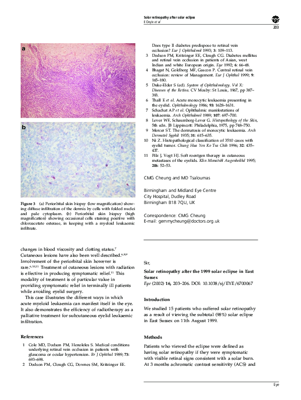 (PDF) Solar retinopathy after the 1999 solar eclipse in East Sussex
