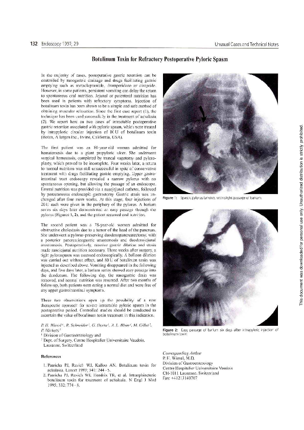(PDF) Botulinum Toxin for Refractory Postoperative Pyloric Spasm | P ...
