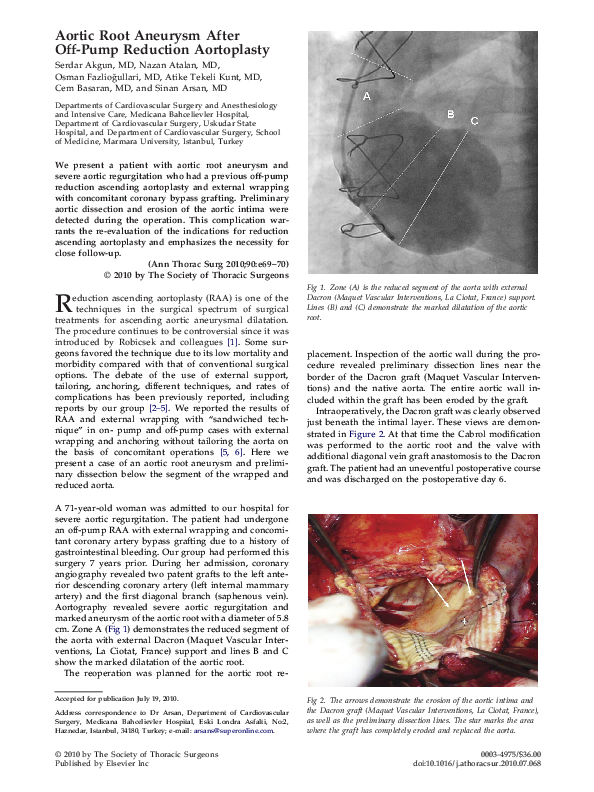 (PDF) Aortic Root Aneurysm After Off-Pump Reduction Aortoplasty | Nazan ...