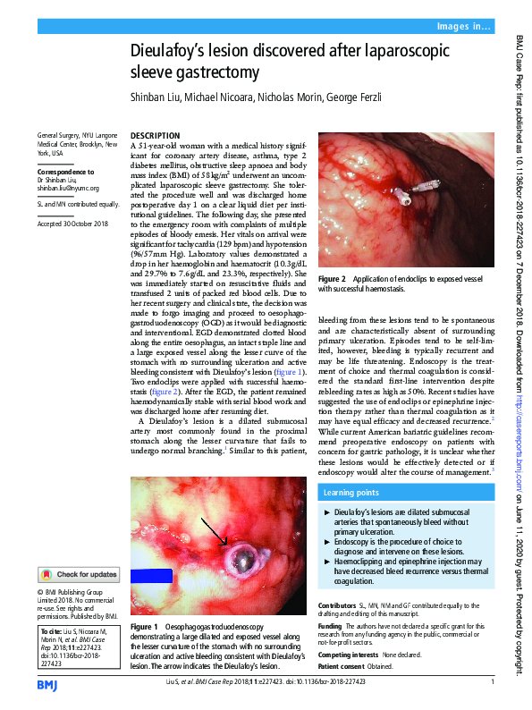 (PDF) Dieulafoy’s lesion discovered after laparoscopic sleeve gastrectomy